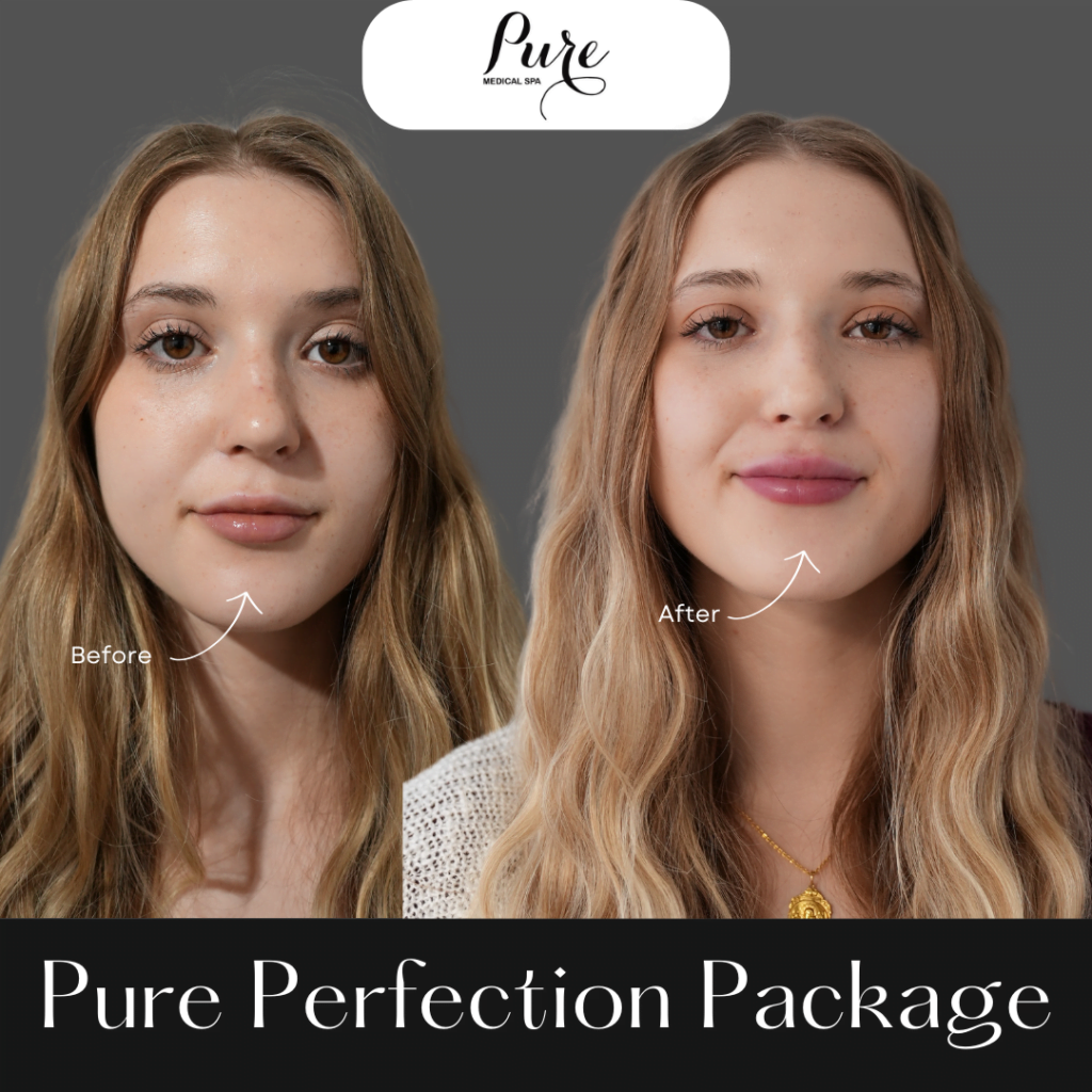 Explore PURE Packages at Pure Med Spa - Affordable Beauty Solutions