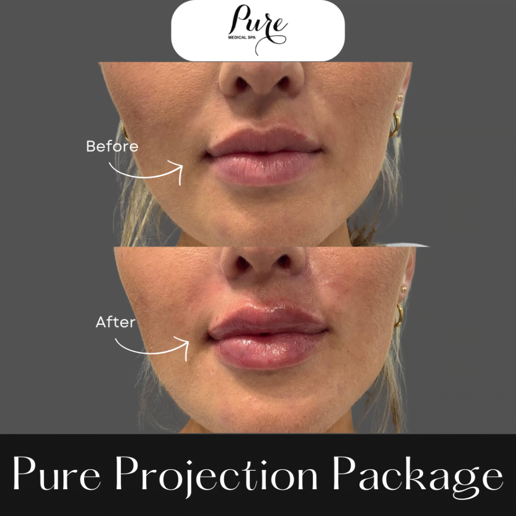Enhance Your Beauty with Pure Projection Package