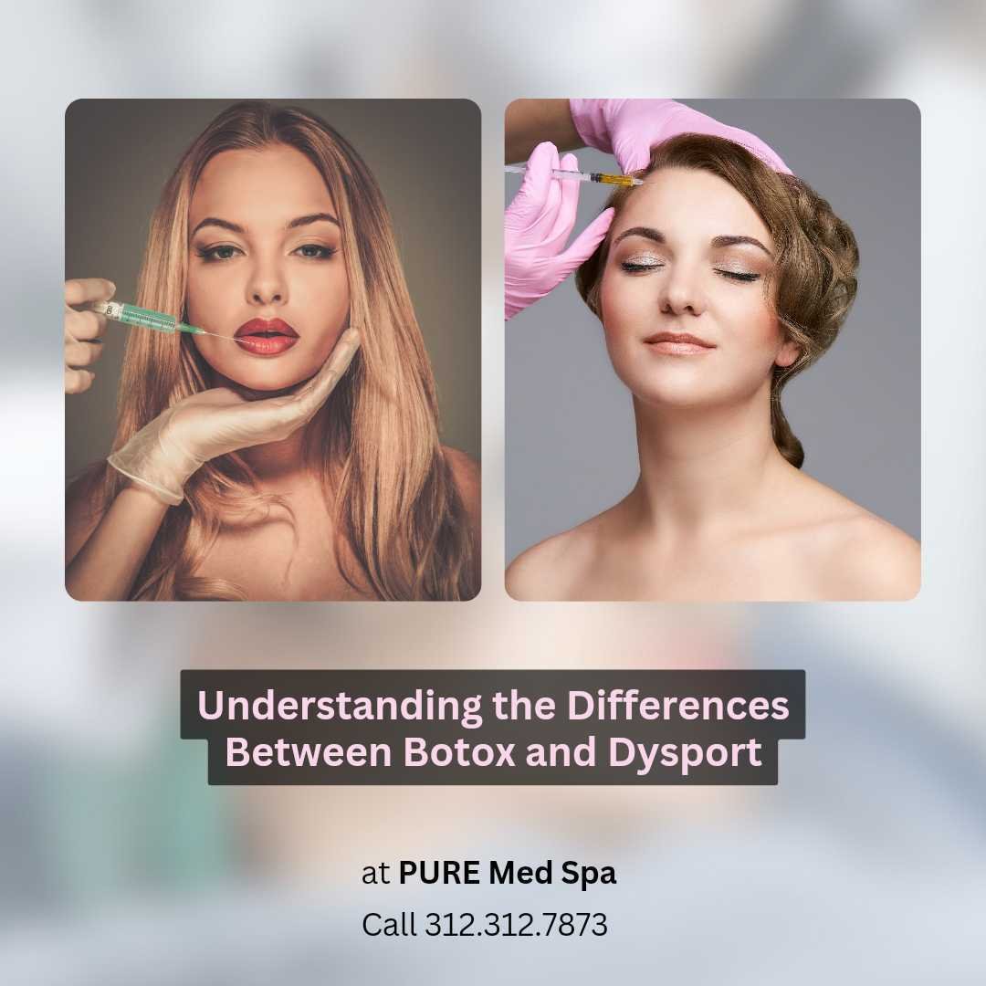 Understanding the Differences Between Botox and Dysport - PURE Medical Spa