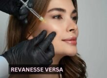 Juvéderm vs Revanesse Versa: Which Filler is Right for You? - PURE ...