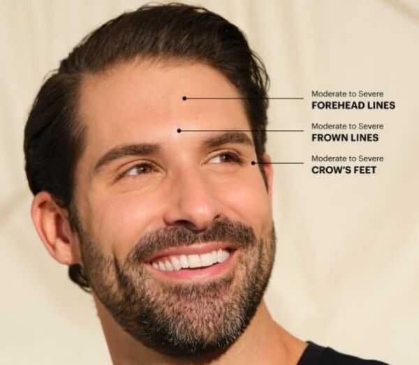 Best Botox Near You: Smooth Wrinkles & Slim with Confidence